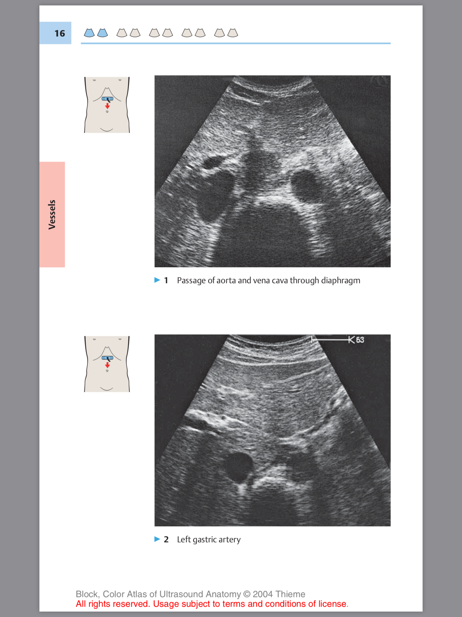 [PDF] Color Atlas of Ultrasound Anatomy – Thieme 2004 – Điện quang và Y ...