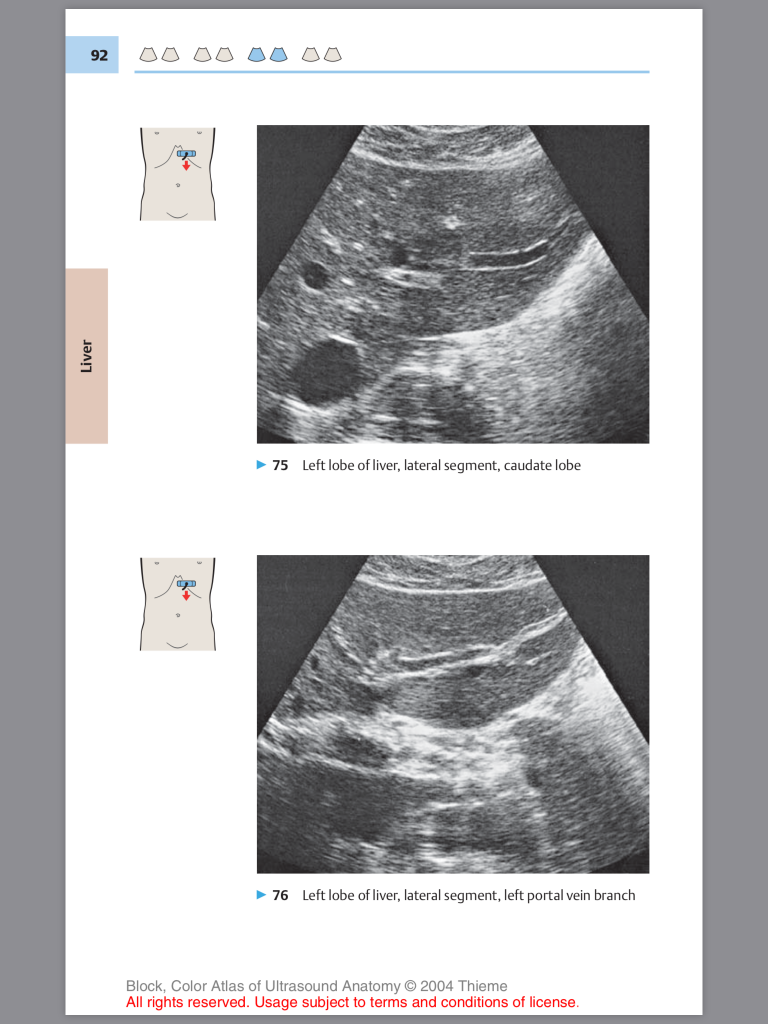 [PDF] Color Atlas of Ultrasound Anatomy – Thieme 2004 – Điện quang và Y ...