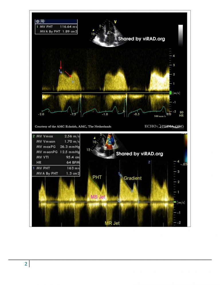 PHT là gì và cách đo cơ bản – Vietnamese Radiology Materials